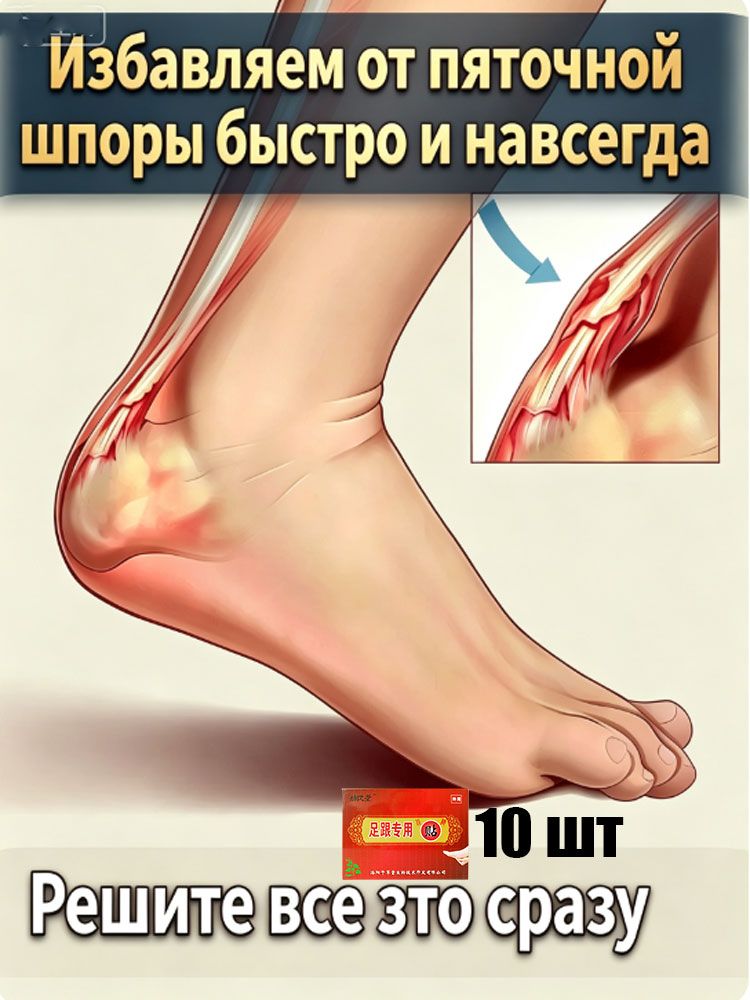 Пластырь от шпоры пяточной кости, пластырь для снятия боли в пятке, лечение шпоры пяточной кости, боли в ногах, тендинита и улучшения состоя
