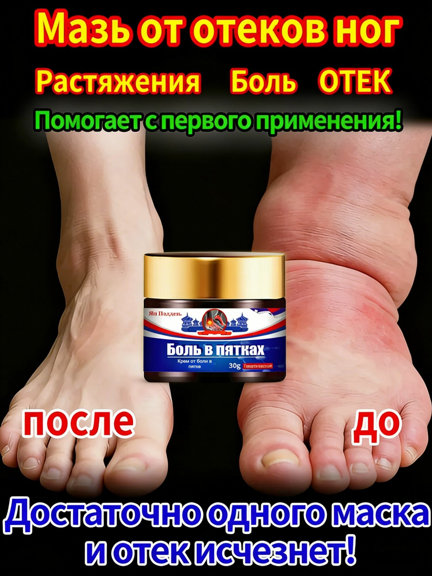 Мазь от отёков ног после ушибов и растяжений 30 г, быстро снимает опухоль и воспаление отёк ушиб растяжение воспаление