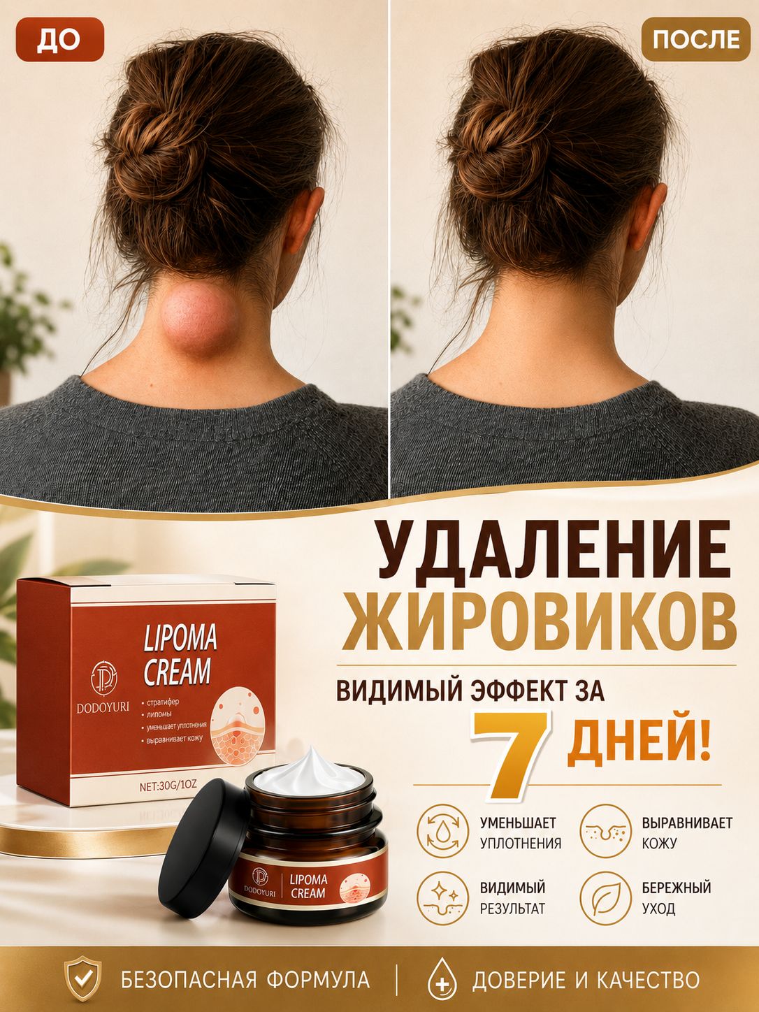 Крем DODOYURI от липом, предназначен для уменьшения подкожных уплотнений, отёков, зоба щитовидной железы и жировиков, 30 г.