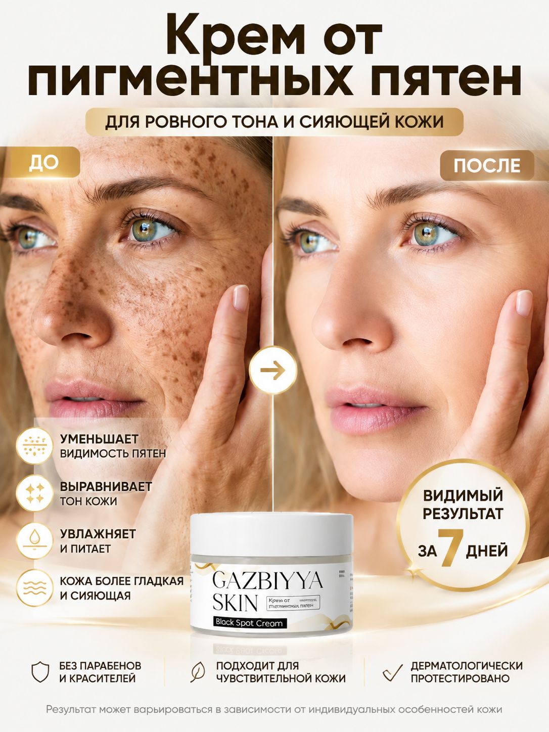 GAZBIYYA SKIN Отбеливающий крем от пигментных пятен и веснушек, против пигментации, Удаление мелазмы и пигментных пятен, Коррекция тона кожи 30г