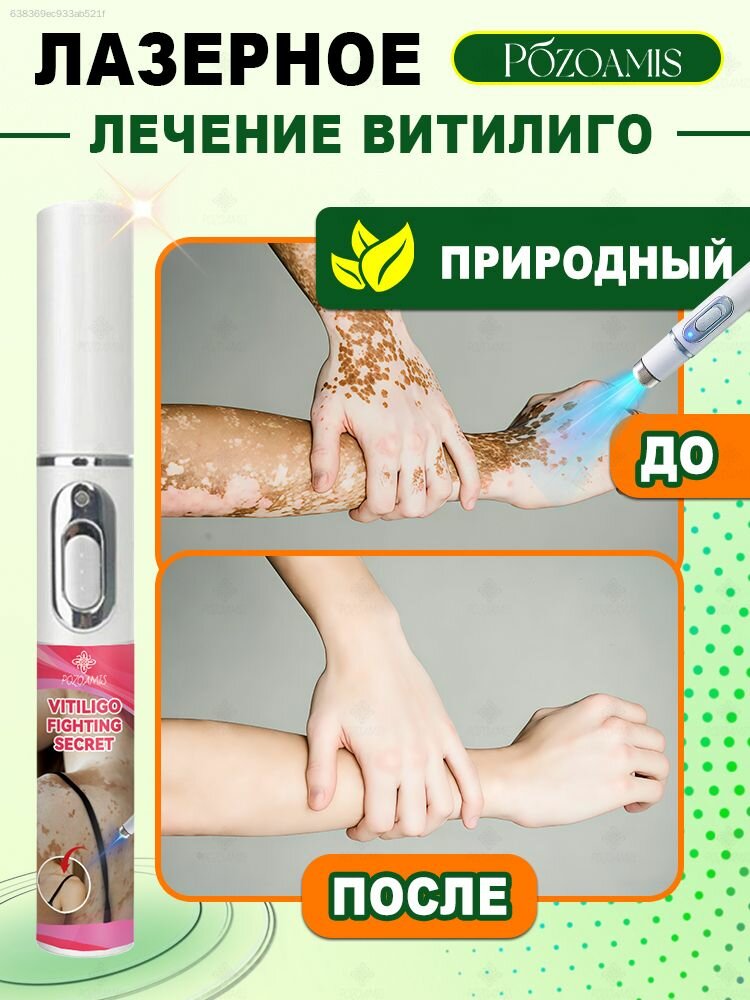 Лазерная ручка от витилиго, Подходит для пациентов с витилиго, Эффективно удаляет белые пятна, устранения пигментации выравнивания тона кожи. средство для улучшения пигментации и выравнивания тона кожи устранение белых пятен восстановление пи