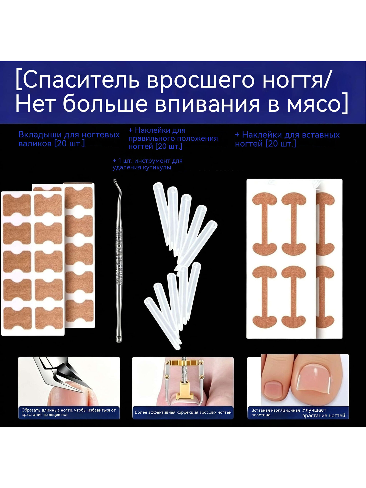 Комплект из 4 корректоров для вросшего ногтя: 2 U-образных и 2 прямых распорки, пластик, бежевый