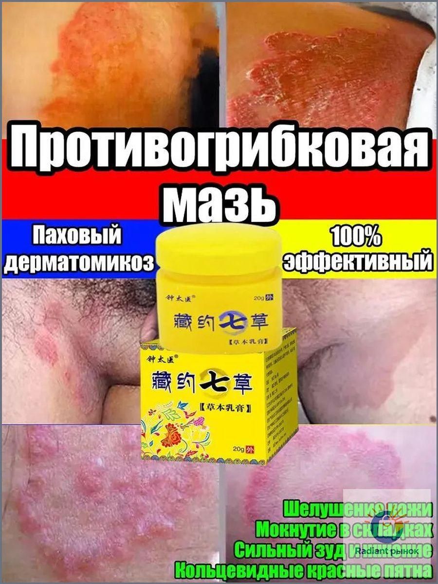 Премиум мазь от грибка кожи, паховая