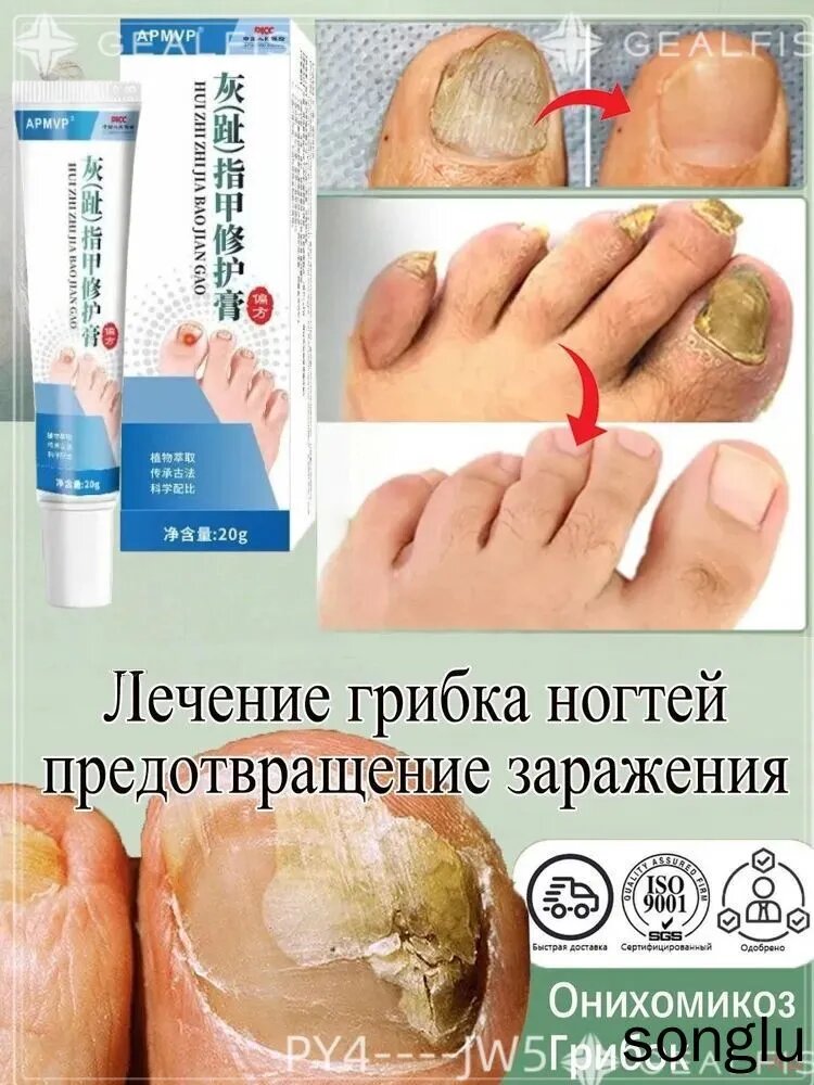При грибке ногтей ног, 20 г, мазь Ноготок, восстанавливает и укрепляет