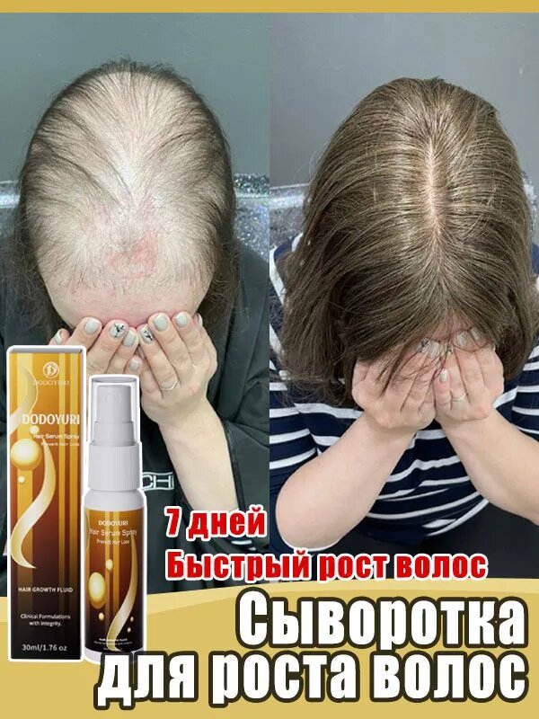 Способствует росту, увеличению густоты, Спрей для роста волос, предотвращает выпадение, стимулирует регенерацию, увеличивает плотность на 90%, натуральные растительные экстракты 30 мл.