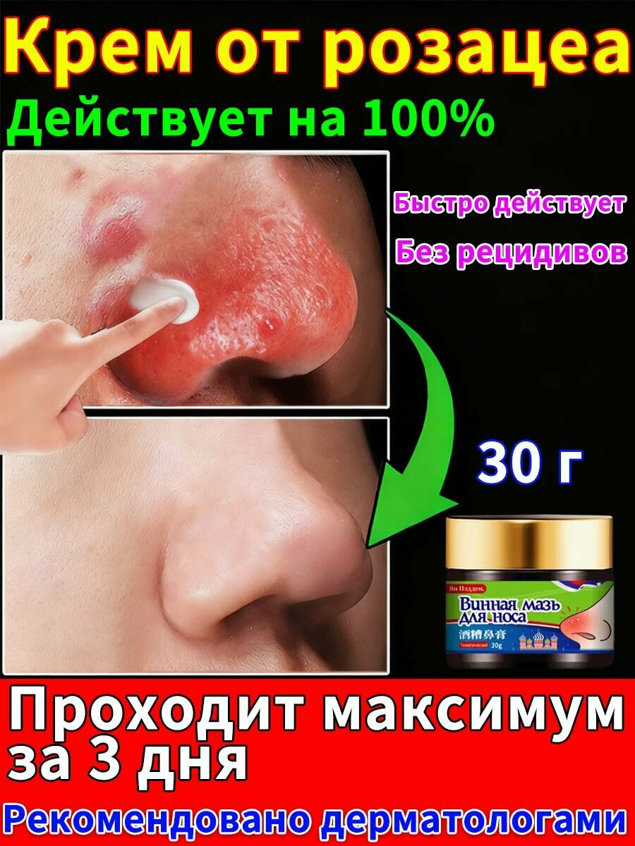 Крем от розацеа 30 г