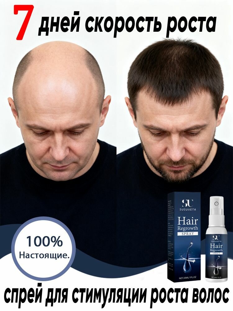 SUSUVETA Подходит для мужчин и женщин спрей для роста волос,+500% густоты, Пробуждение спящих фолликулов 30Мл