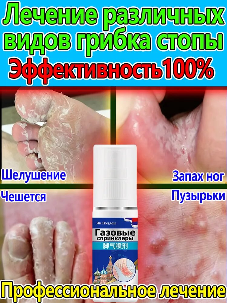 Противогрибковый спрей, от грибка ногтей на ногах, от трещин, для пяток и стоп, мазь от псориаза, зуда, микозе, спрей для ног
