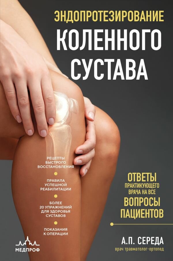 Книга МЕДпроф Эндопротезирование коленного сустава. Ответы практикующего врача на все вопросы пациентов. 2024 год, А. П. Середа, 272 стр