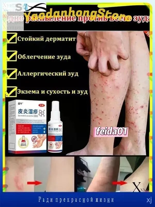 Эксклюзивный спрей 60 мл для снятия зуда при дерматите, герпесе, экземе и грибковых поражениях кожи