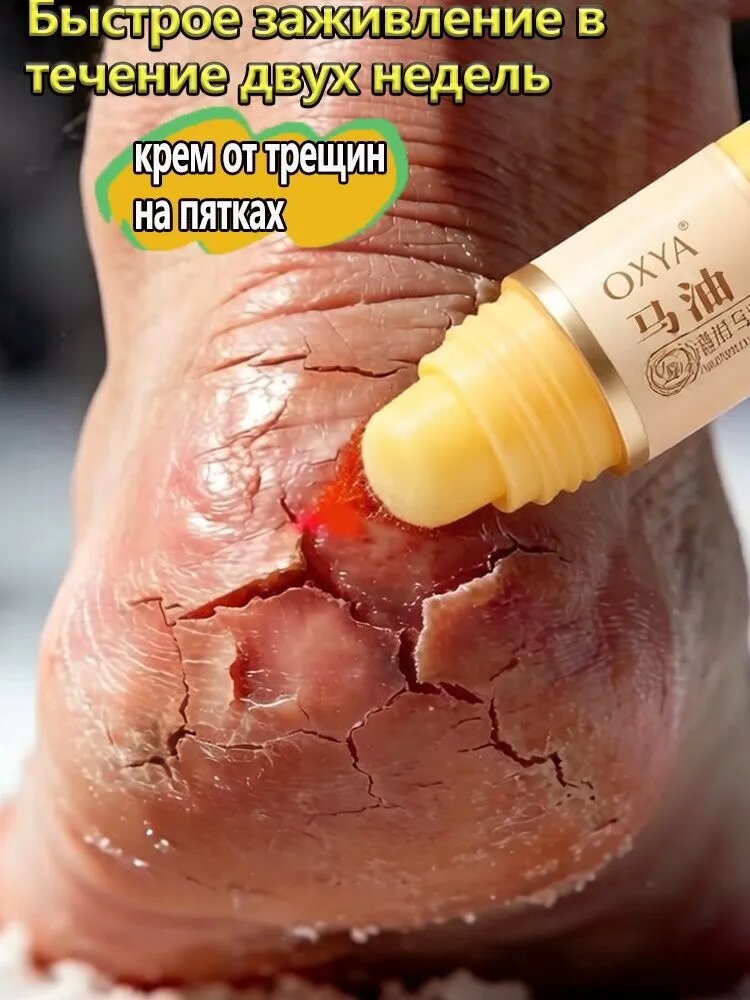 Крем воск для ног с мочевиной 5 , от трещин на пятках, увлажняющий
