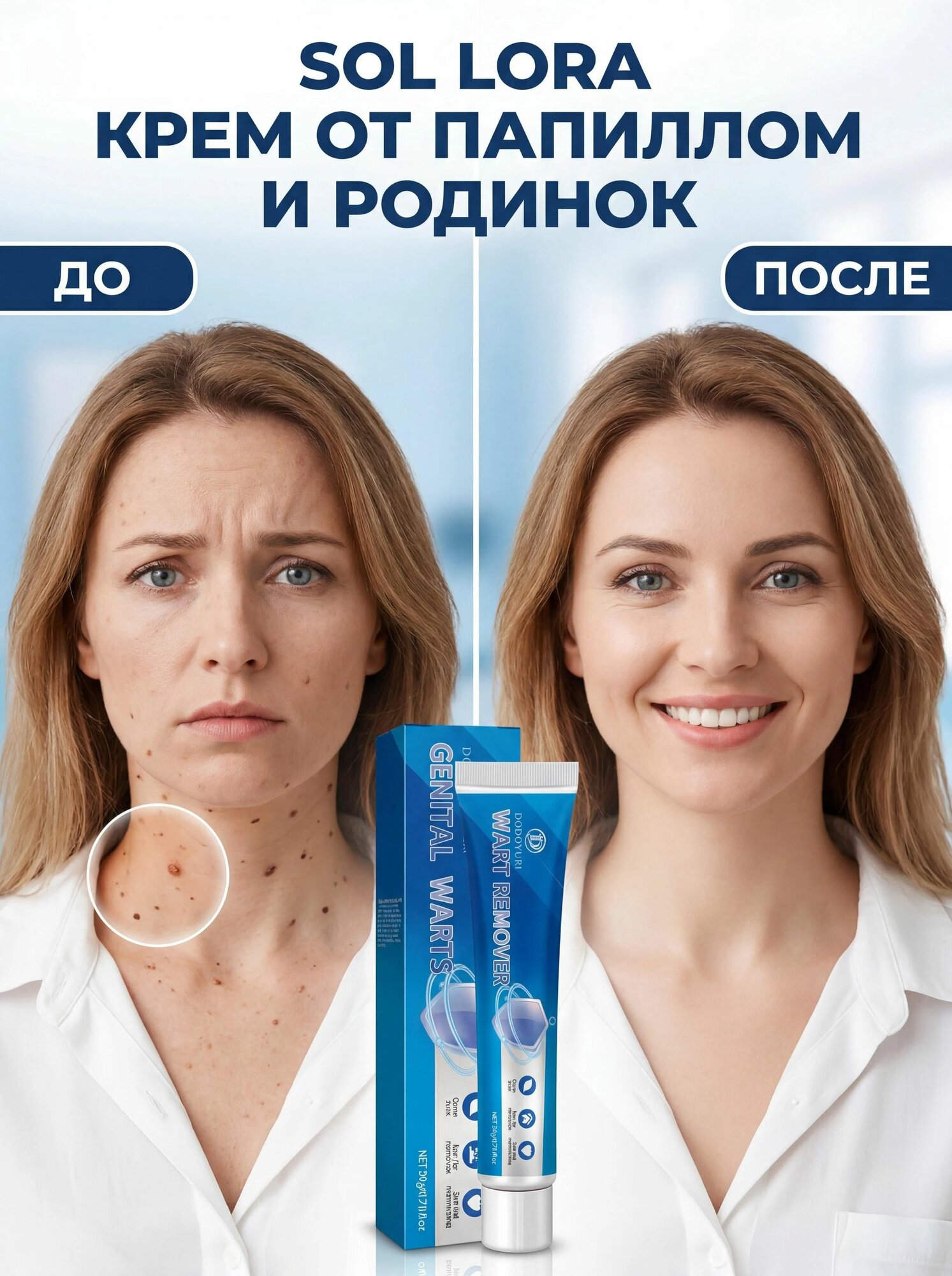 Средство от папиллом, 20 г, эффективно удаляет бородавки, папилломы и родинки на лице и теле, безболезненно и без следов от бородавок от родинок