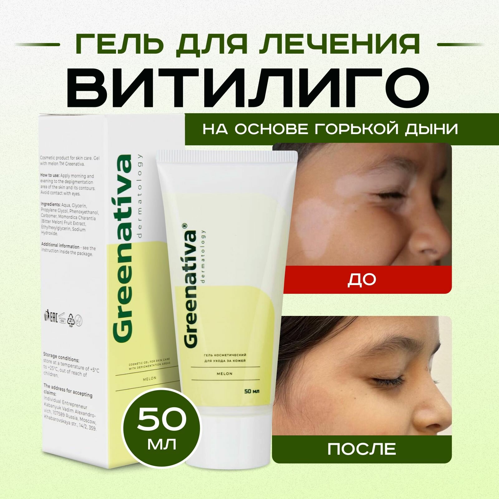 Крем от витилиго кожи на основе горькой дыни Greenativa 50 мл