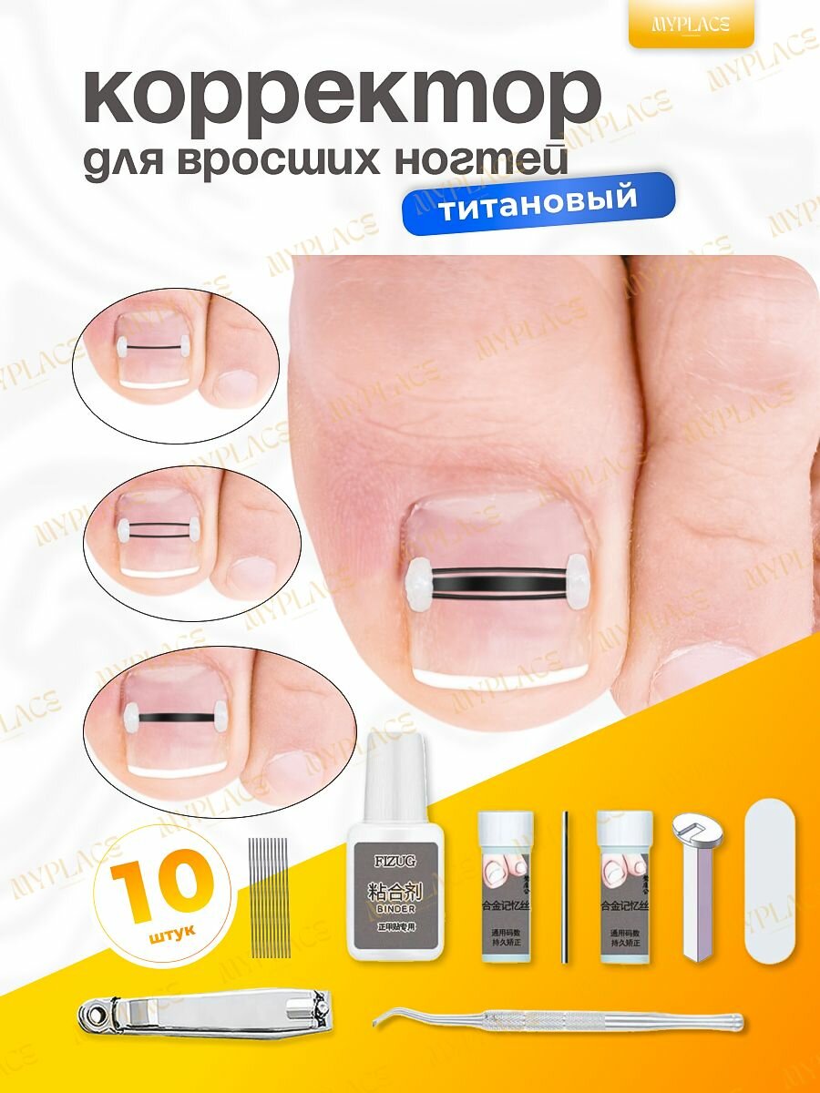 Набор инструментов , комплект корректоров для лечения вросших ногтей на ногах для ног набор для вросших ногтей