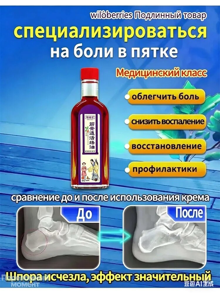 Медицинская желчь для пяточной шпоры жидкая 51 г