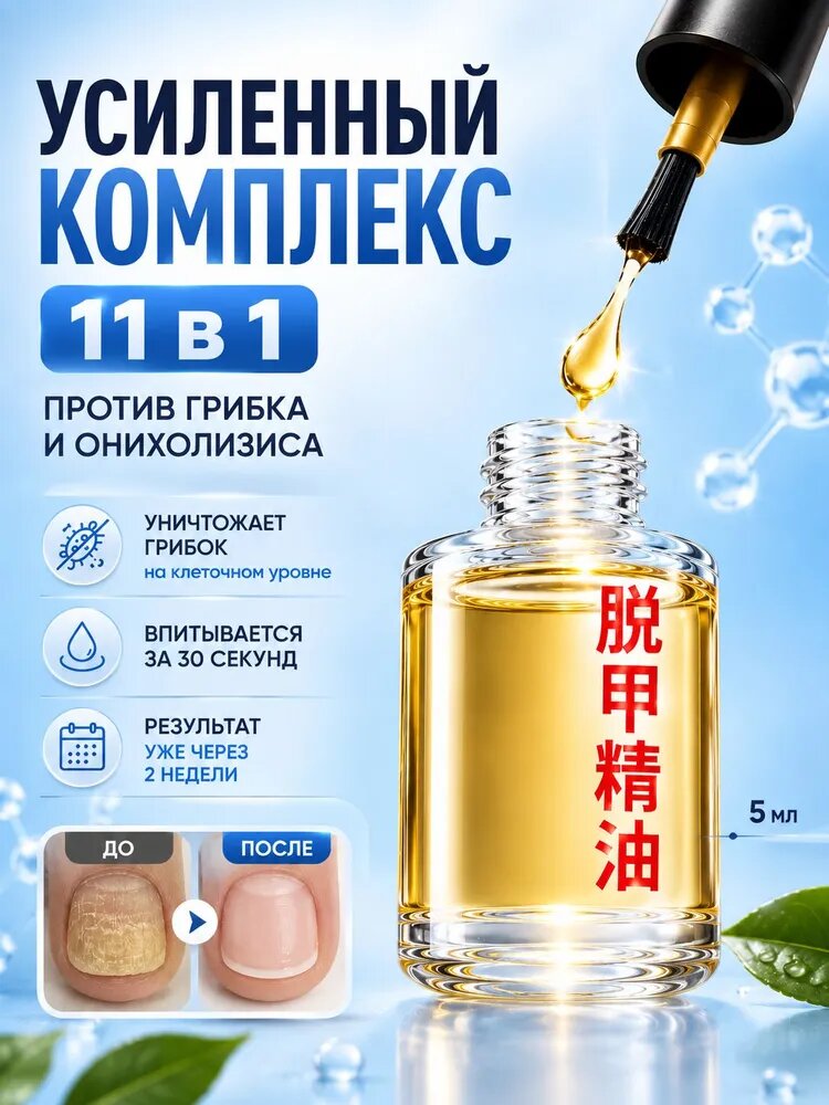 Средство от грибка ногтей на ногах, стоп онихолизис, 5 мл, Продукция косметическая гигиеническая: масло для ногтей и кутикулы