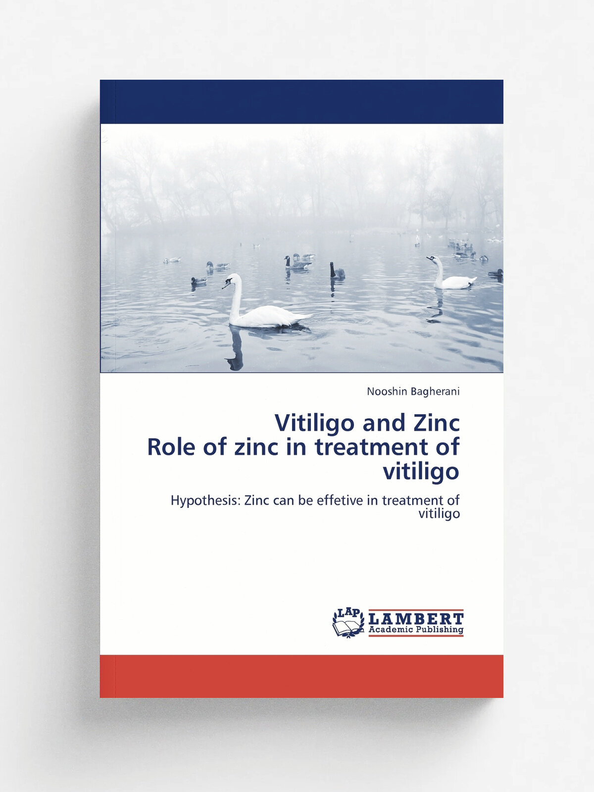 Vitiligo and Zinc Role of zinc in treatment of vitiligo