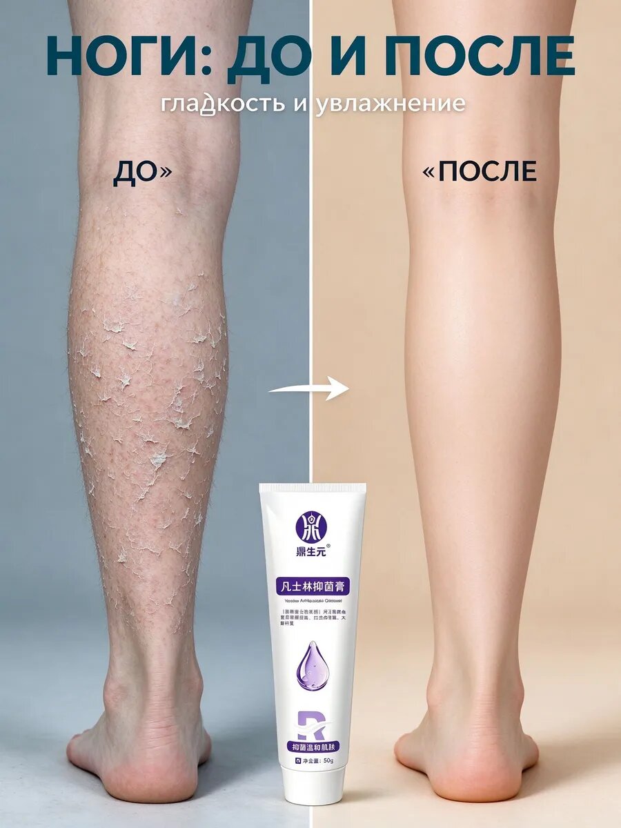 Крем пилинг мочевина 30%
