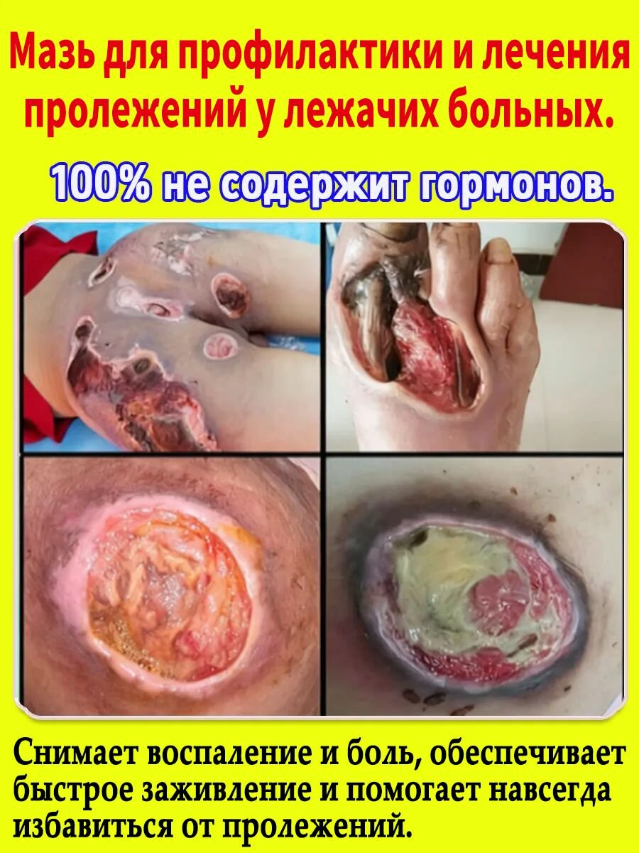 Гель для лечения пролежней заживляющий для лежачих больных, повязка от пролежней, 20 г