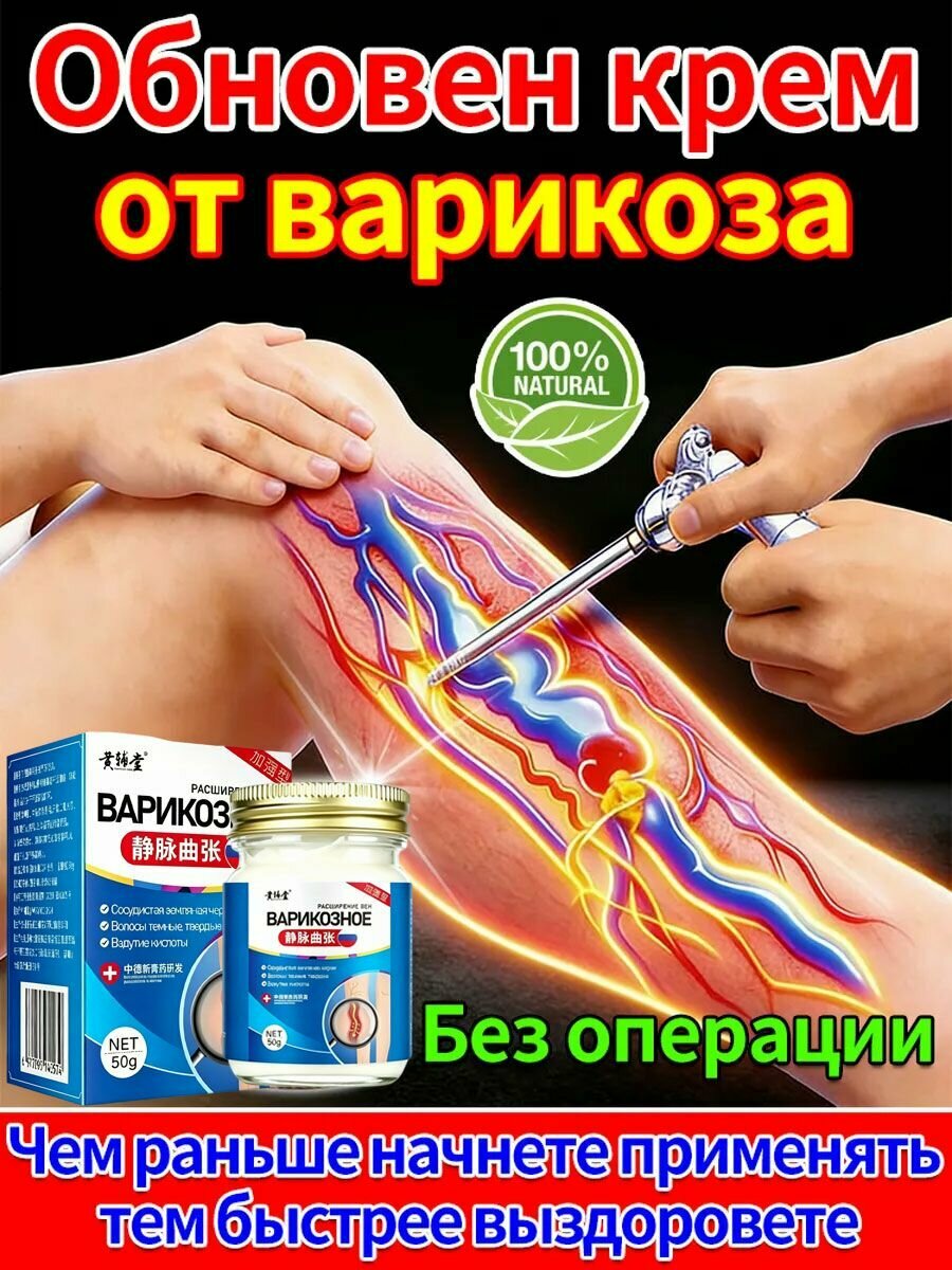 Крем от варикоза из Японии, венотоник от отеков и тяжести в ногах, крем от венозных сеточек при тромбофлебите