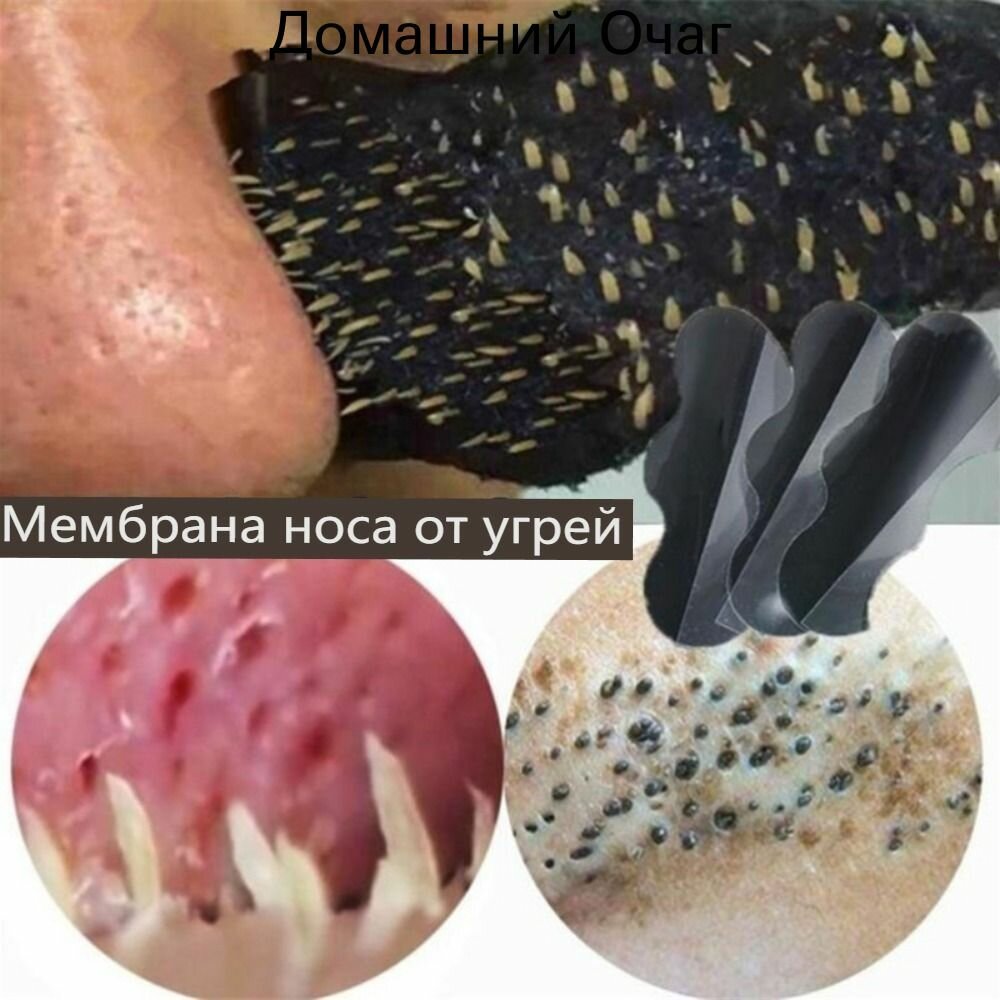 Очищает нос от прыщей, удаляет угри, уменьшает размер пор, глубокое очищение, нежные полоски для носа 10 шт.