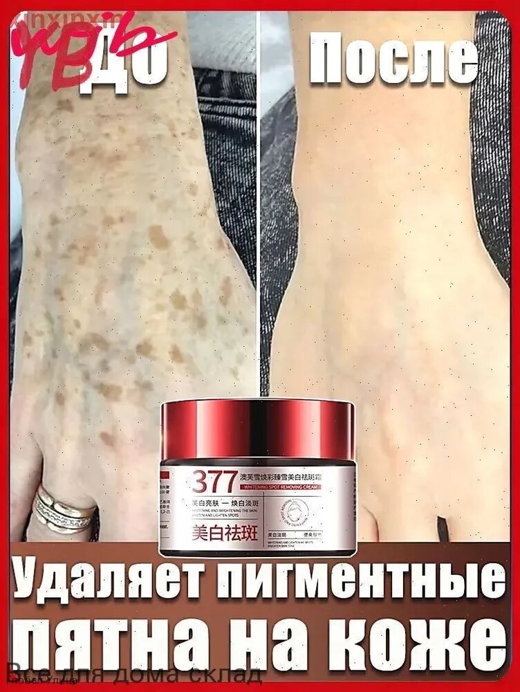 Крем от пигментации для лица, удаляет пигментные пятна, против пигментации, осветляет, для мужчин и женщин, 30 г