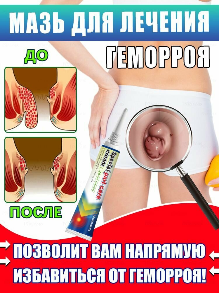 Крем от геморроя быстро снимает боль, устраняет зуд и отек, заживляет трещины заднего прохода, улучшает кровообращение, содержит натуральные ингредиенты и не вызывает ощущения жжения. без жжения натуральный для заживления трещин