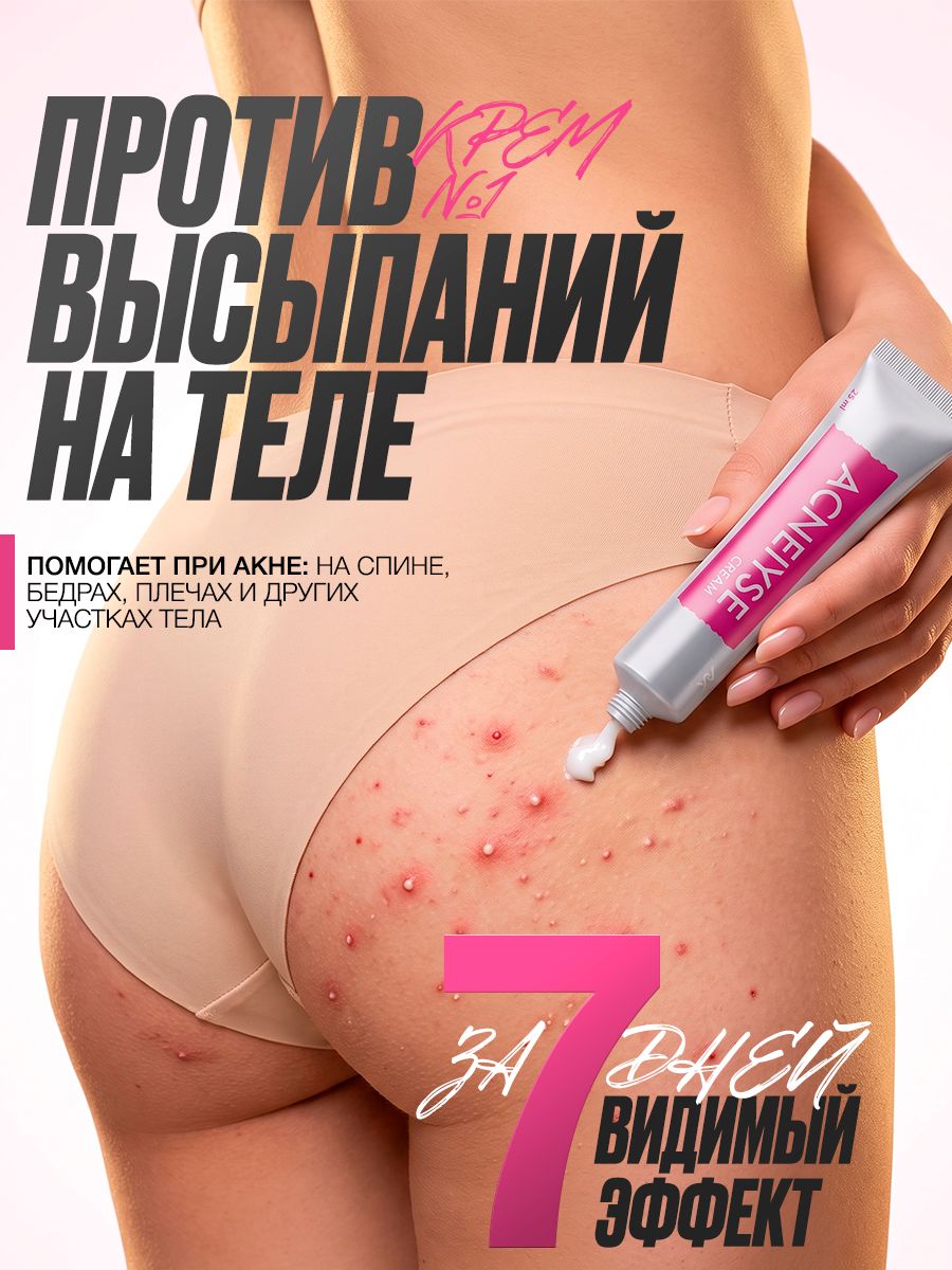 Крем с ретинолом ACNEIYSE / От акне и постакне, для проблемной кожи лица, от шелушения, от покраснений, от пигментации / 25 мл