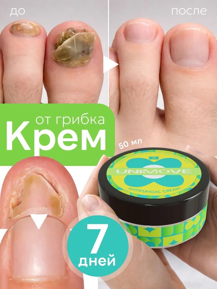 Мазь / масло от грибка ногтей, эффективное средство от грибка ногтей на ногах и руках, Unimove, 50 мл, стоп онихолизис