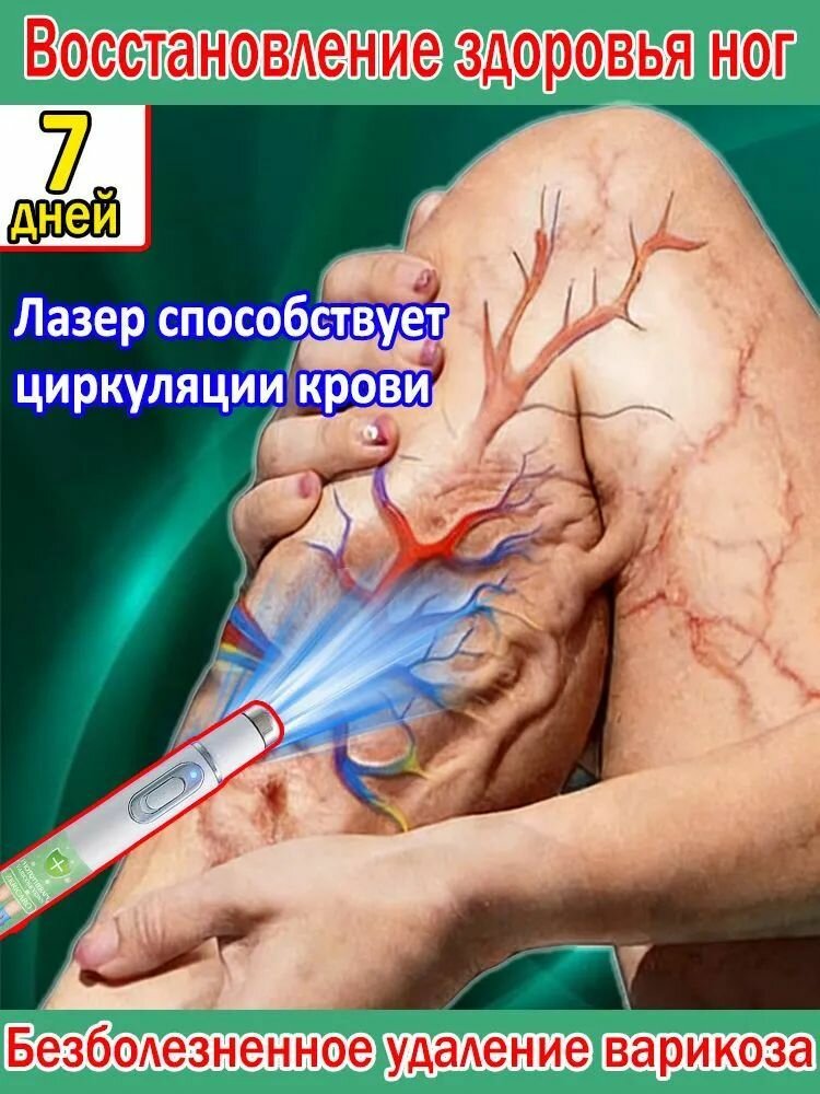 Качественный компрессионный комплект для ног, устраняющий отечность и воспалительные процессы в венах, предотвращающий тромбообразование, с двумя лазерными указками в наборе противоварикозные гольфы с лазерными указками для вен