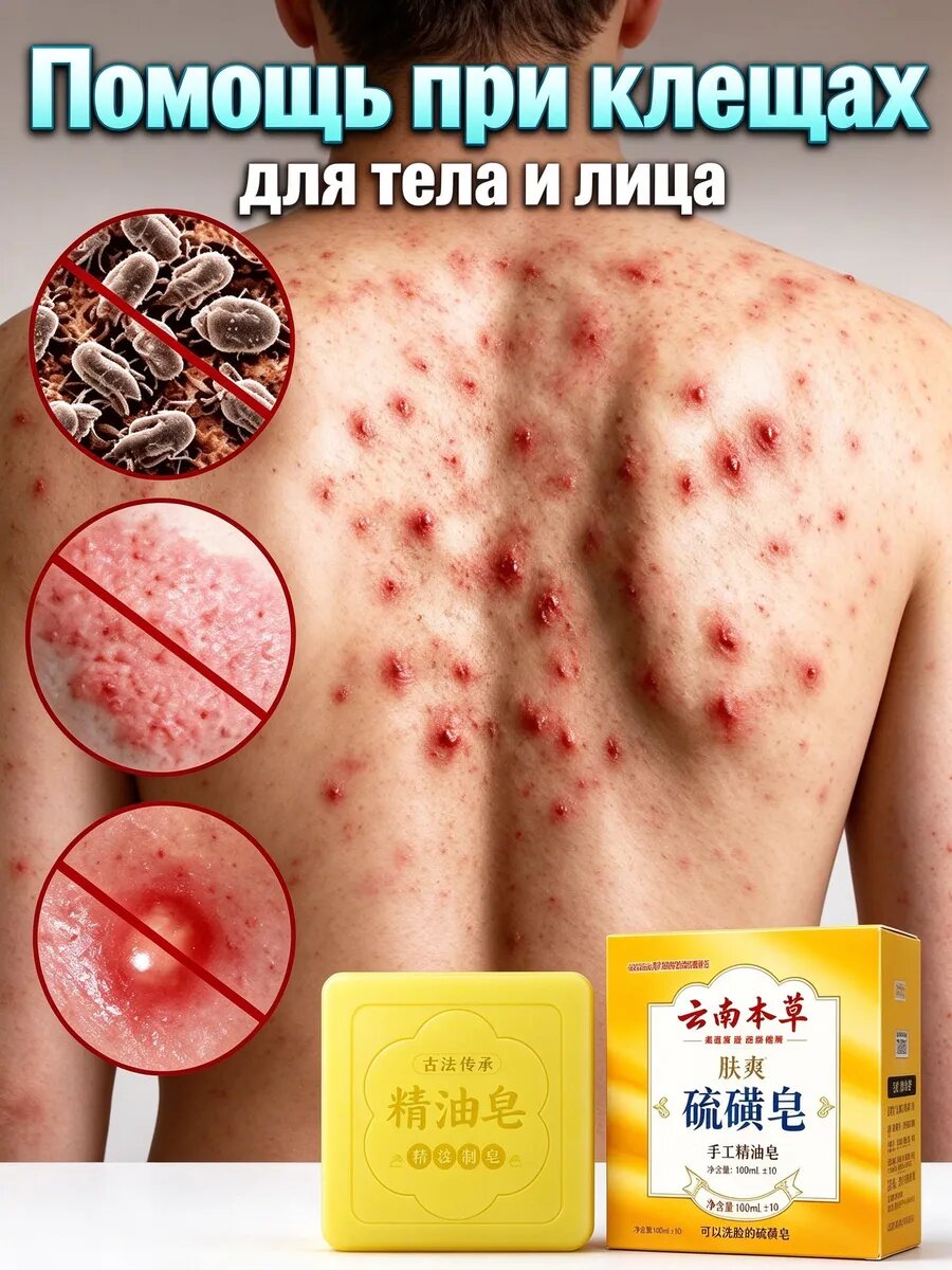 Мыло серное от перхоти 100г
