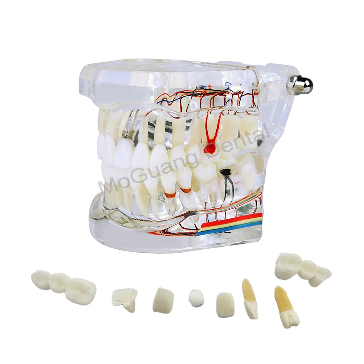 Модель зубов имплантата MOGODENT Dental Teeth Implant Model M2001-2
