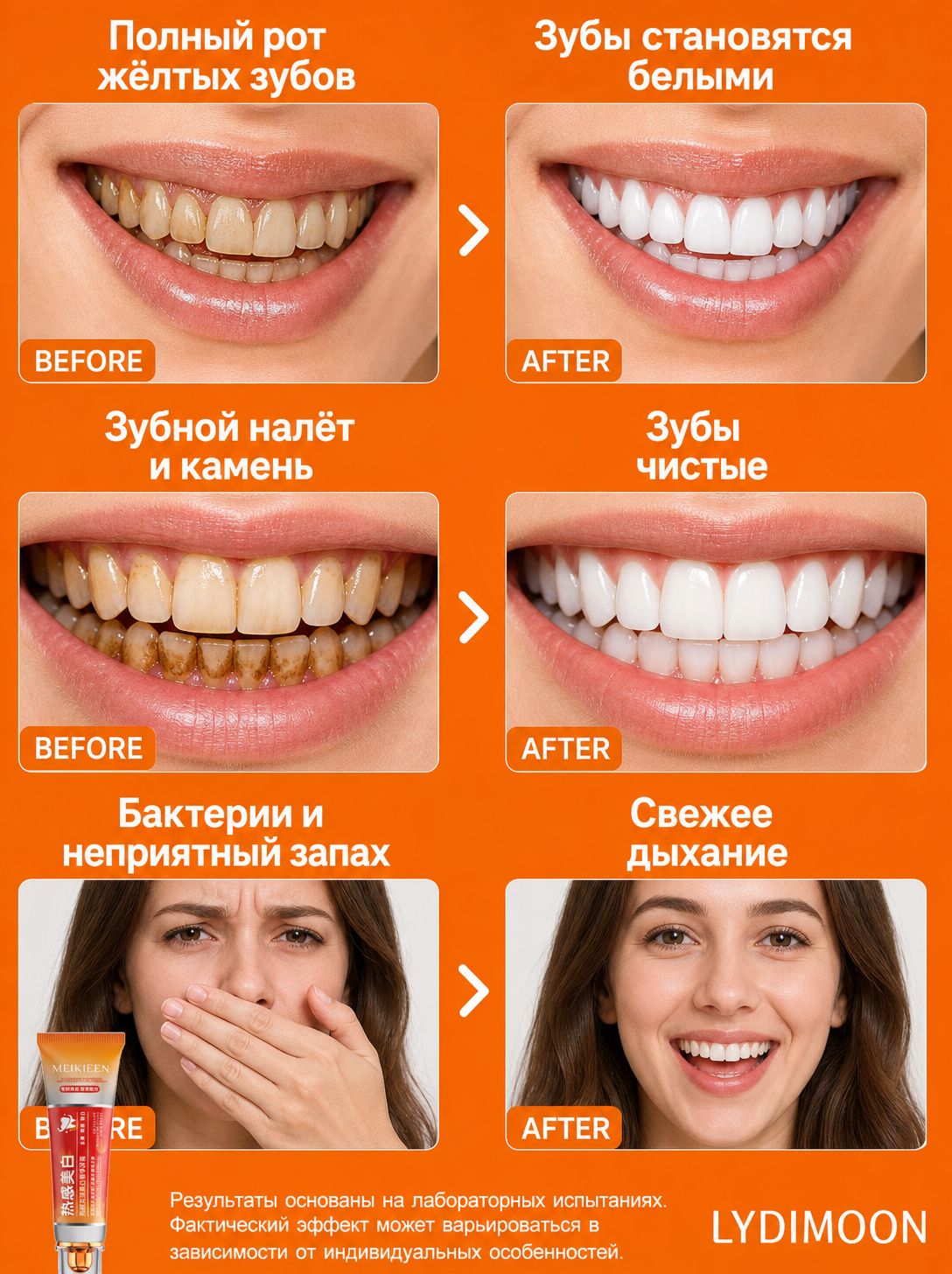 Зубная паста отбеливающая без фтора 120 г. Содержит антибактериальный лизоцим, для чувствительных зубов и десен, от кариеса, камня и налета, с
