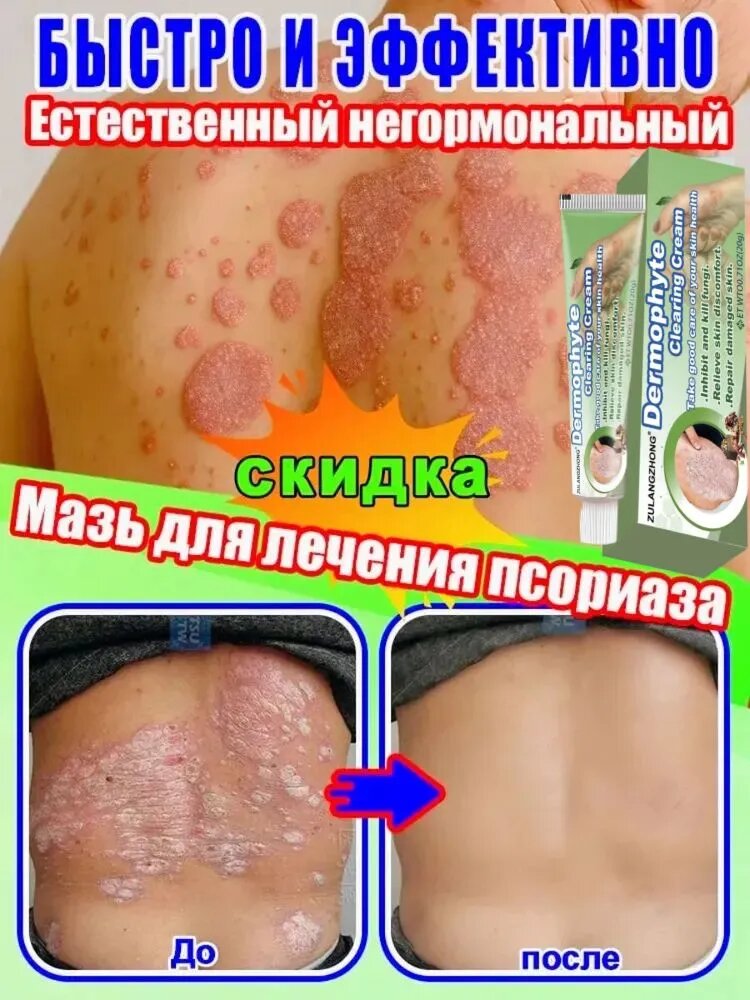 Присыпка 20 мл