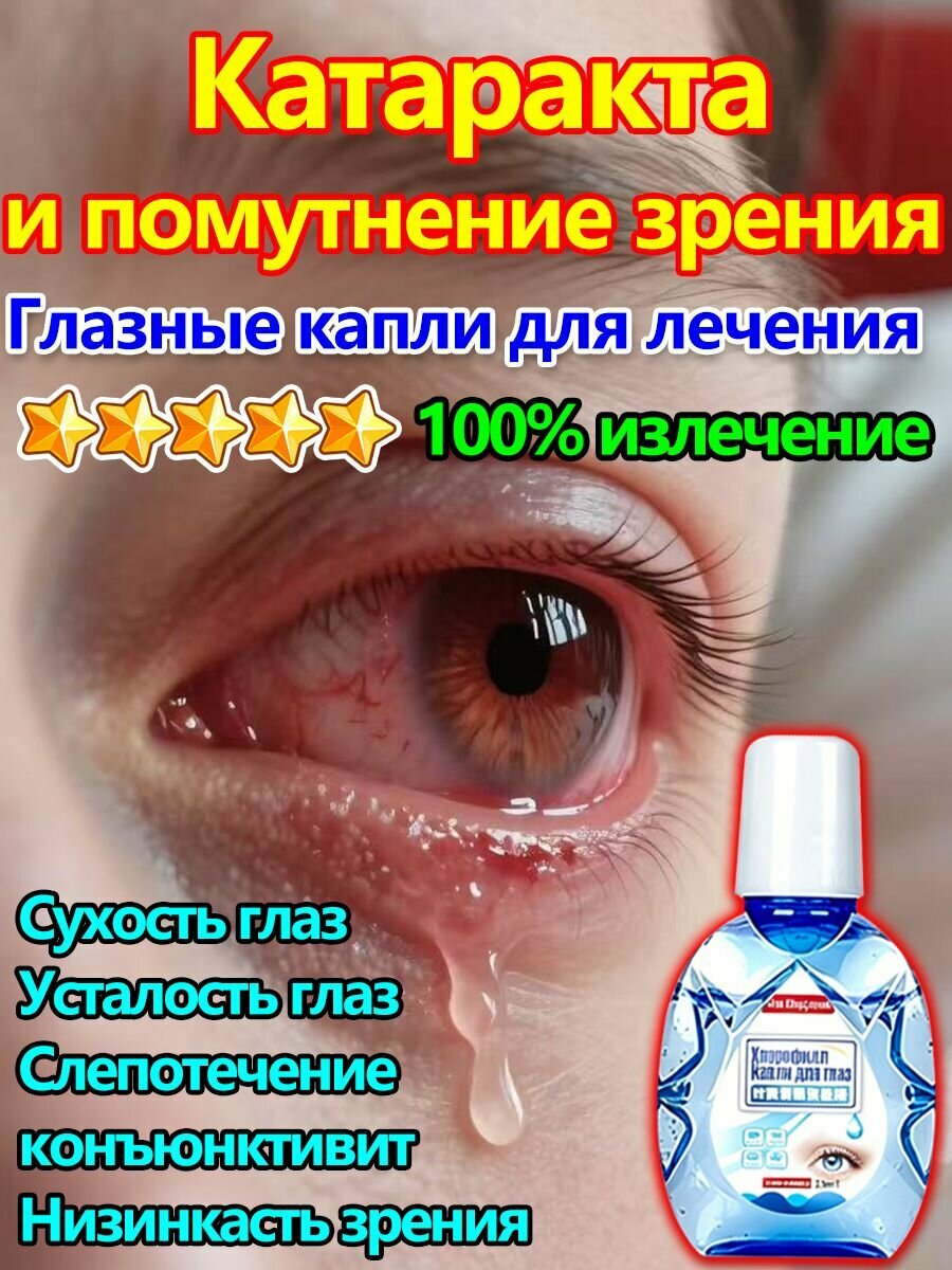 Глазные капли Ястреб от нечеткости зрения и сухости глаз 13 мл