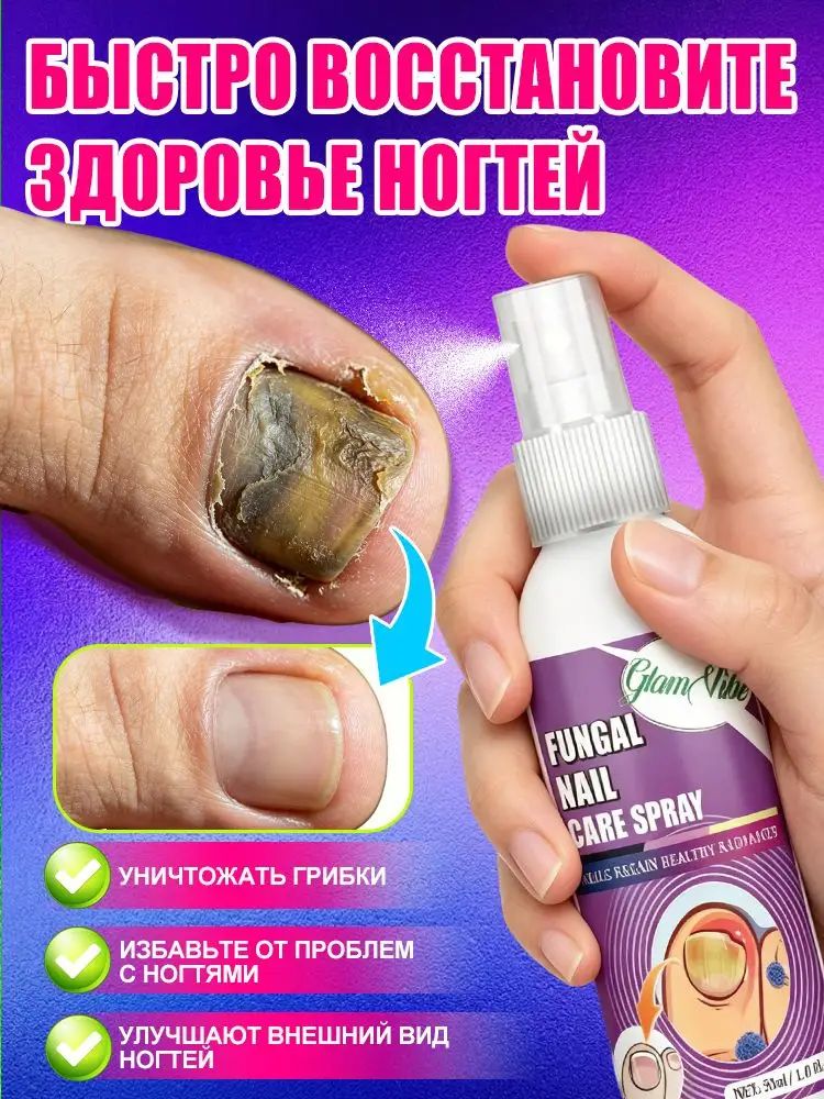 Противогрибковый спрей от онихомикоза антибактериальное действие, размягчение и восстановление поражённых ногтей. Без гормонов. 30 мл