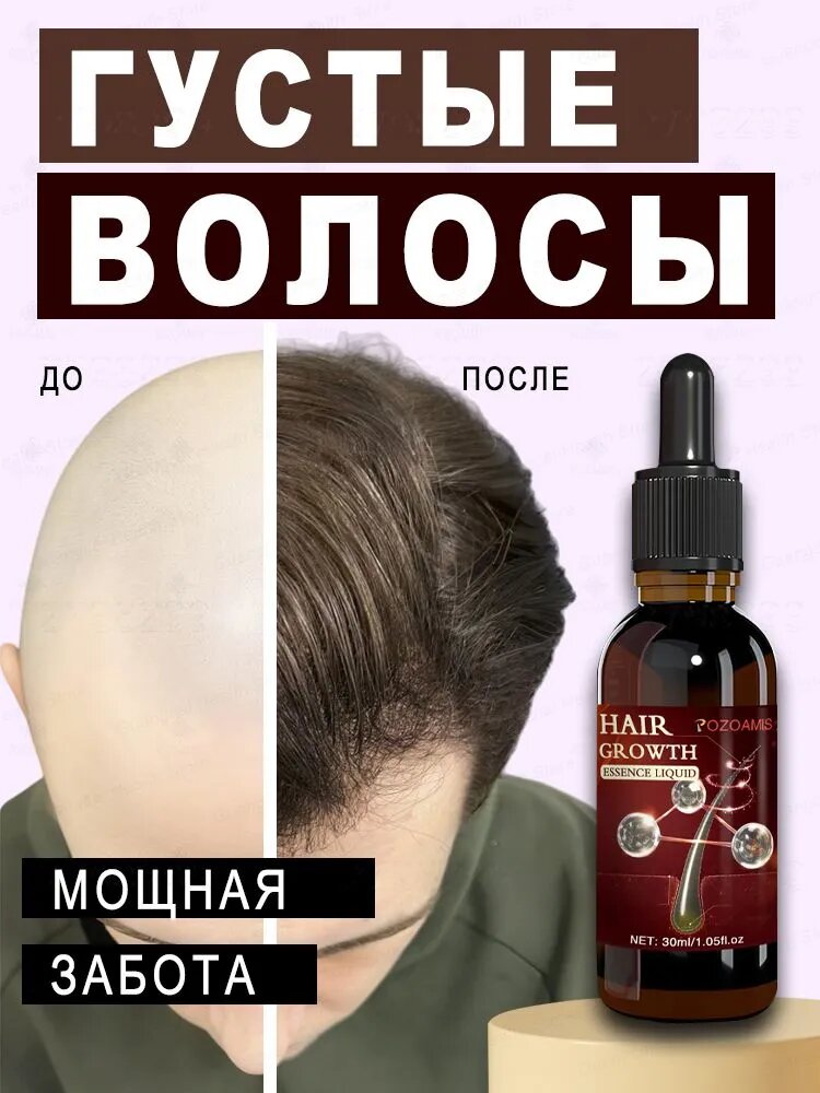 POZOAMIS-18O Лосьон для волос, 150 мл