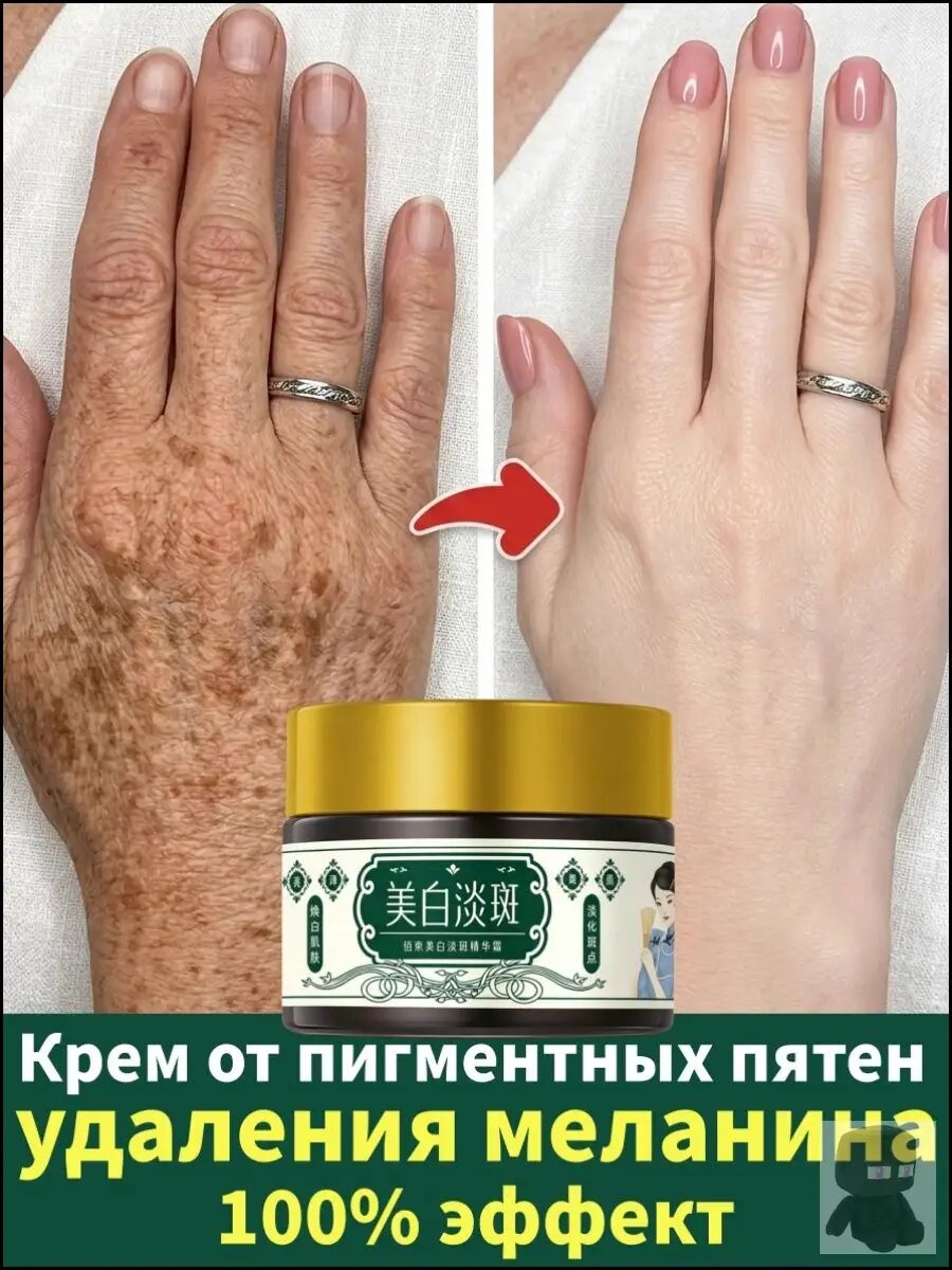 Крем от пигментных пятен, для уменьшения пигментации, эффективно удаляет солнечные пятна, осветления веснушек, выравнивает и осветляет тон кожи, Отбеливающий крем 30 г