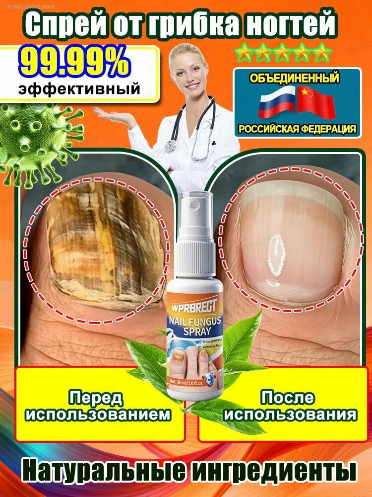 Противогрибковый спрей для ногтей, предназначенный для лечения грибковых инфекций ногтей на ногах, 30 мл.