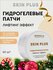 Патчи