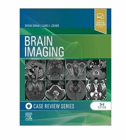 Brain Imaging: Case Review Series Reprinted books