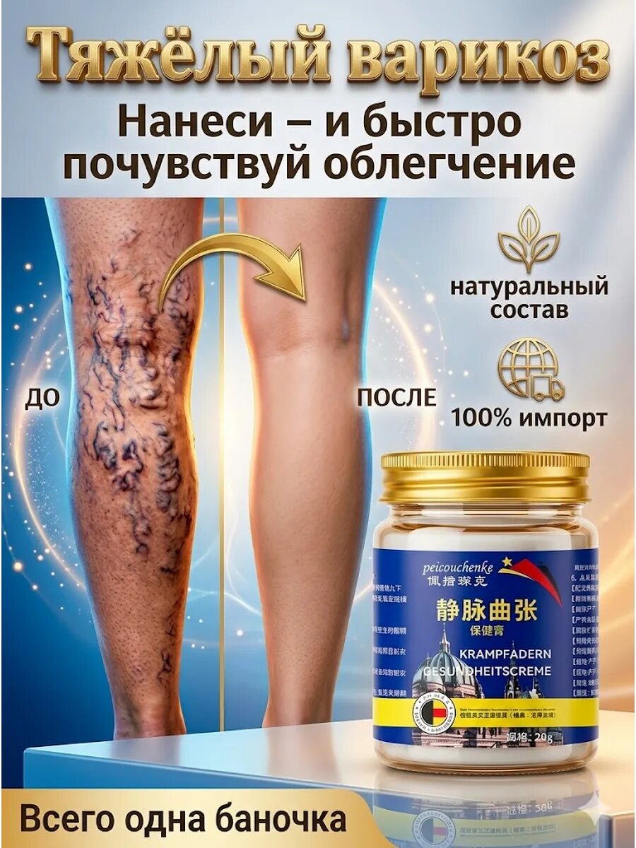 Мазь от варикоза вен на ногах