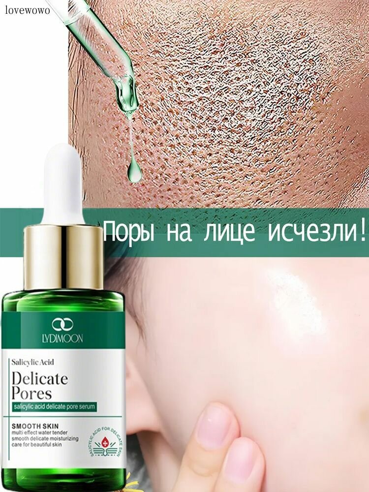 Сыворотка для сужения пор, уменьшает поры на лице, сужение пор, контроль себума, делает кожу более гладкой и мягкой, 30 мл.