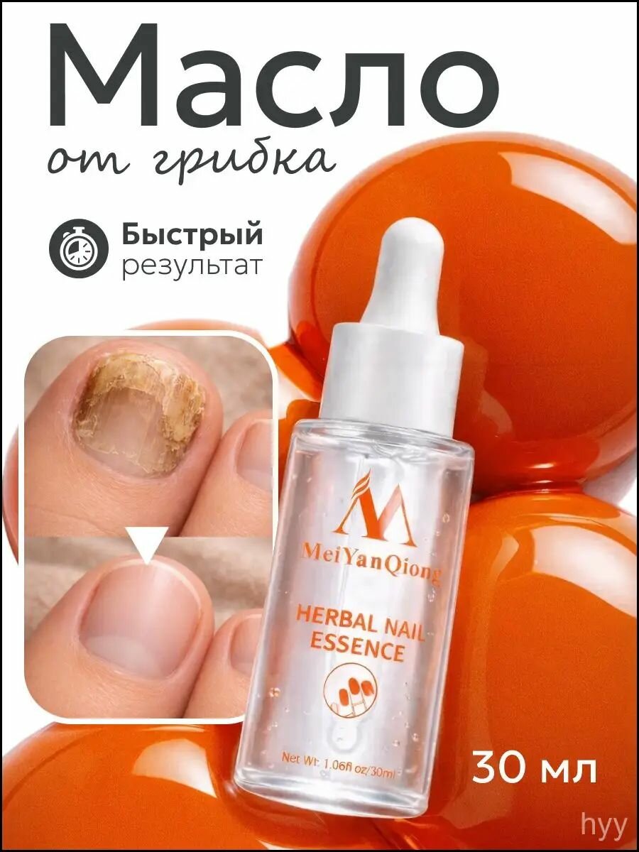 Масло для ногтей от грибка, средство для лечения грибка Nail Fungus, 10 мл, лечение онихолизиса