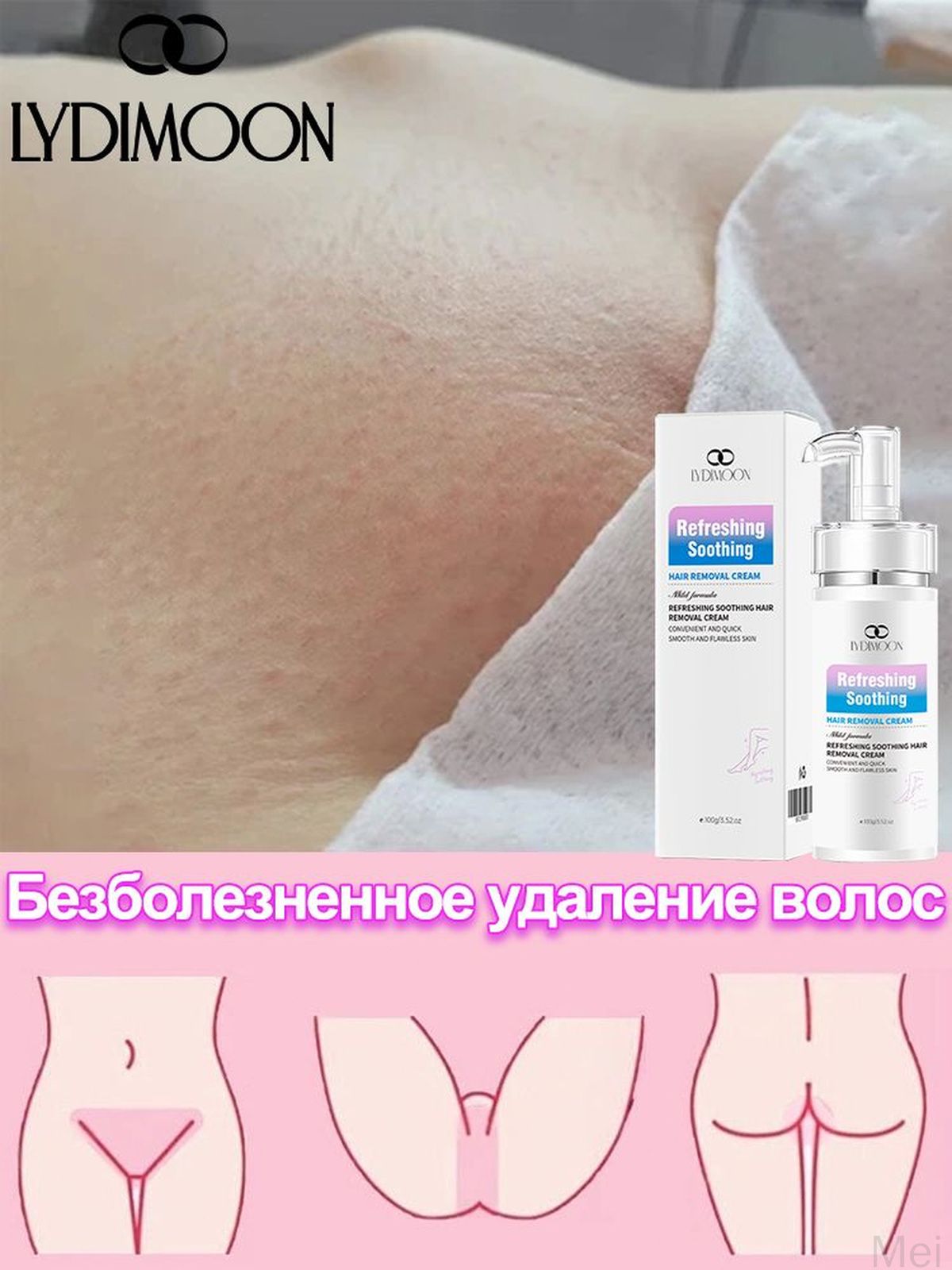 Спрей для депиляции, спрей для удаления волос на ногах, руках или бикини, без боли и раздражения, 100 мл