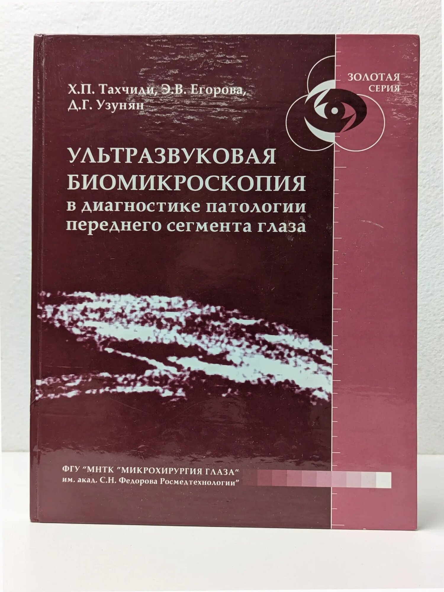 Золотая серия. Ультразвуковая биомикроскопия в диагностике патологии переднего сегмента глаза Тахчиди Христо Периклович, Егорова Элеонора Валентиновна, Узунян Джульетта Григорьевна 2007