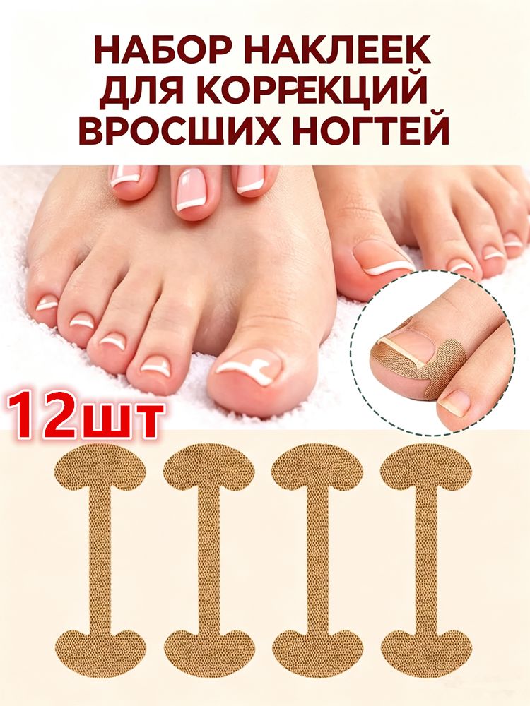 Набор наклеек для коррекции вросших ногтей / Пластырь для исправления пластины при онихокриптозе / Педикюрная корректирующая система для приподнимания ногтя на ноге
