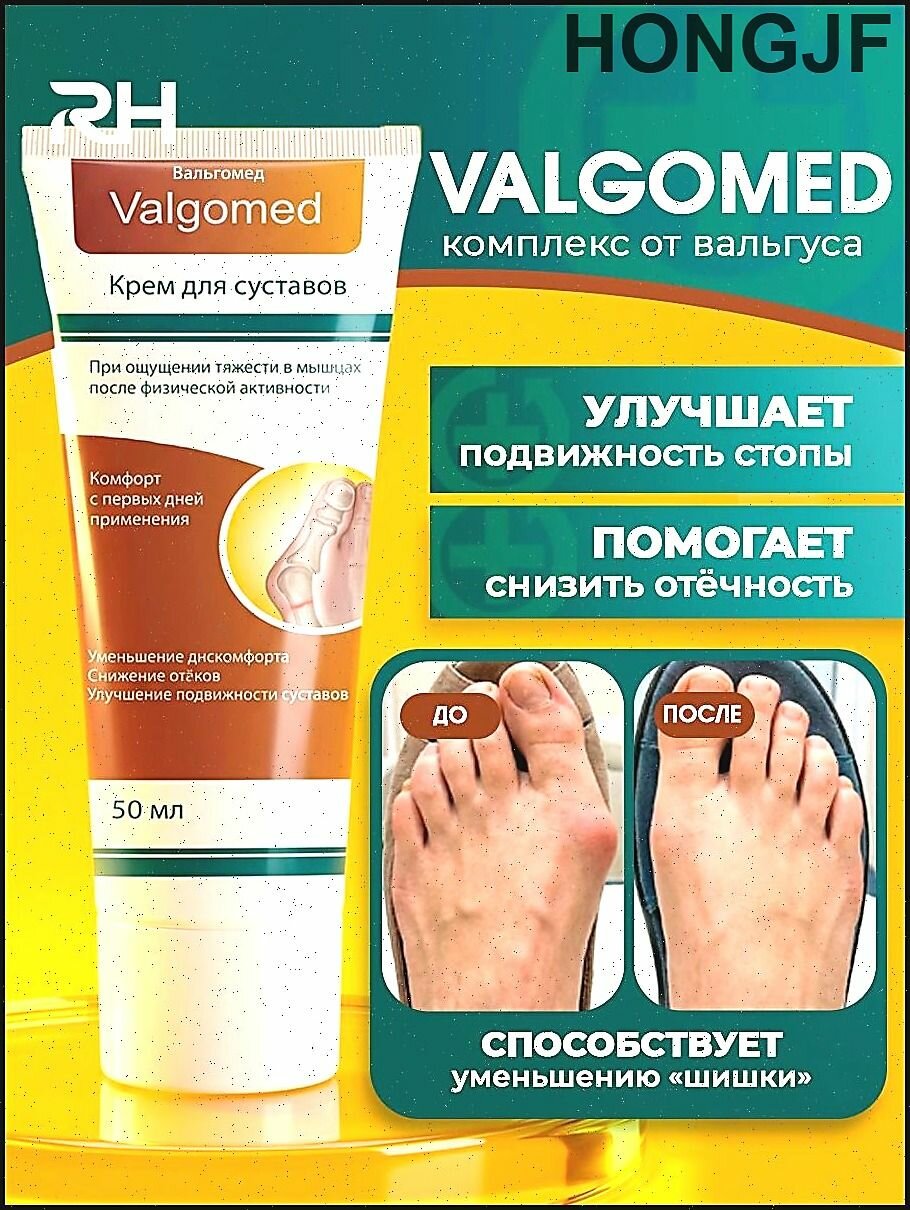 Комплекс для суставов и вальгусе - Valgomed / Вальгомед