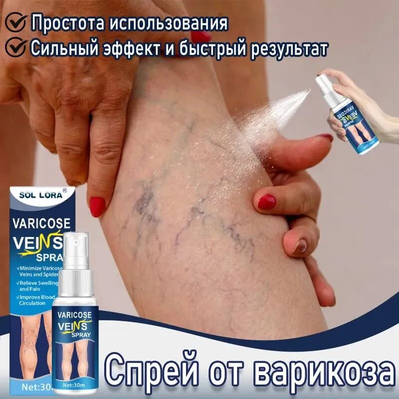 Спрей от варикоза, 30мл , эффективен при сосудистых звездочках, тромбозе, фитокрем для укрепления сосудов, вен, от тяжести ног, венозные воспаления и облегчает состояние при варикозе