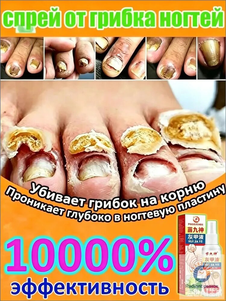 Спрей от грибка ногтей,30 мл, для лечения плесневых инфекций, укрепления ногтей, удаления рогового слоя и устранения онихомикоза.